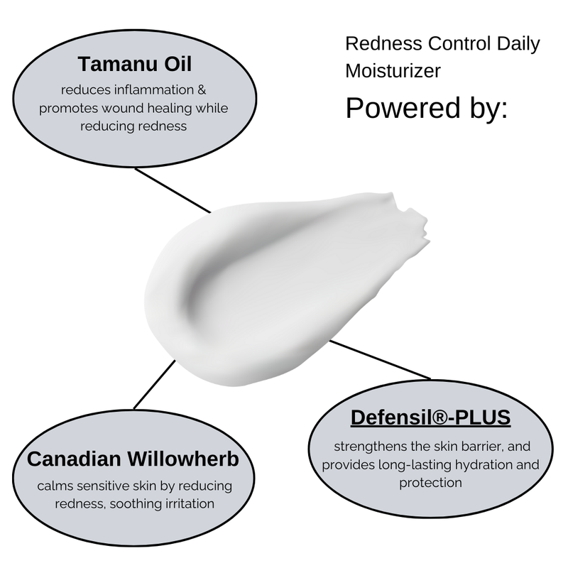 Rosacea Vs Eczema Whats The Difference 0264